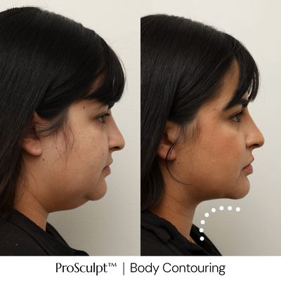 PROSCULPT - Updated December 2025 - 28 Photos - 10845 Main St, Bellevue ...