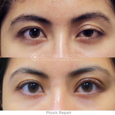 JEFFREY JOSEPH, MD - Updated November 2025 - 46 Photos & 99 Reviews ...