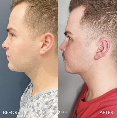 JASON EMER, MD - Updated December 2024 - 1071 Photos & 498 Reviews ...