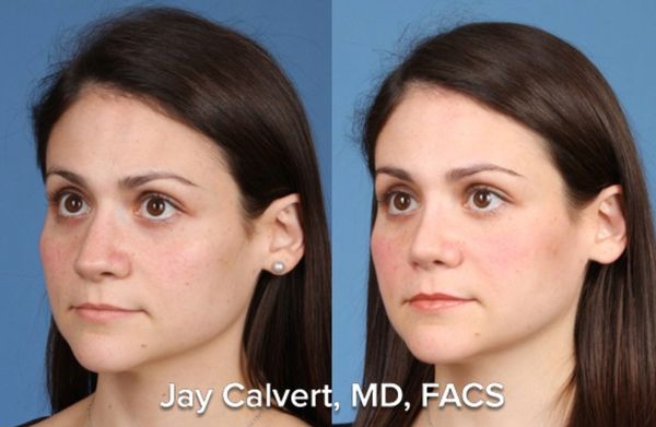 DR JAY CALVERT PLASTIC SURGERY - Updated December 2025 - 39 Photos & 34 ...