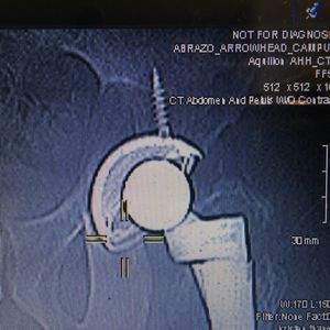 SHANE MARTIN, MD - Updated October 2025 - 18 Reviews - 20401 N. 73rd St ...