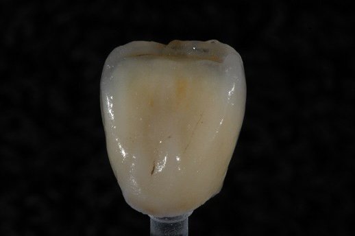 INFUSION DENTAL ARTS - Updated December 2025 - 20 Photos - 4944 ...