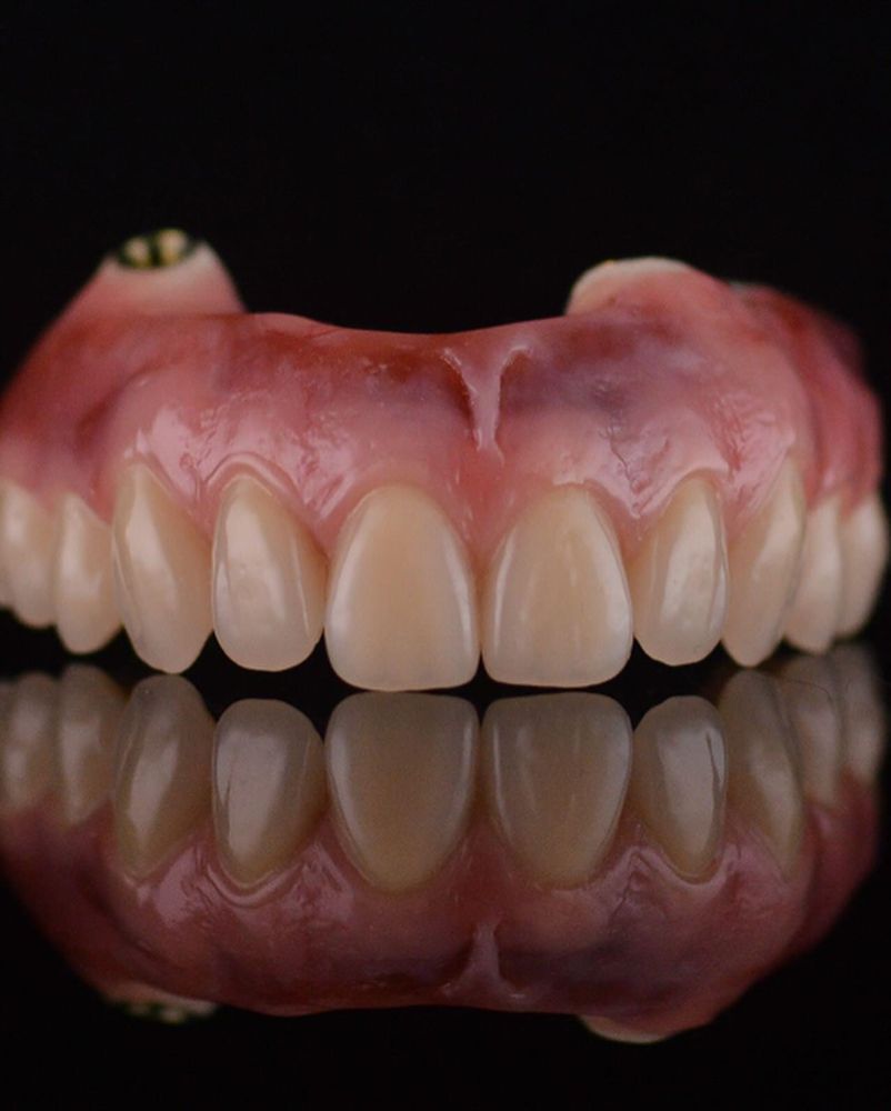 DENTAPURE TECHNOLOGY - Updated October 2025 - 13 Photos - 1426 W 6th St ...