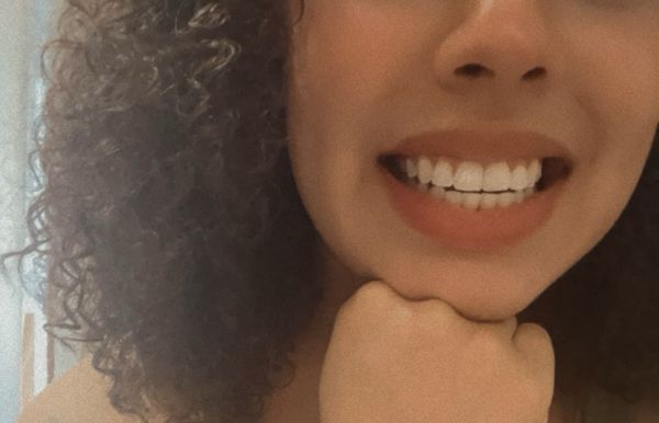 AFDENT - Updated December 2025 - 13 Photos & 59 Reviews - 605 W Douglas ...