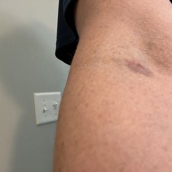 LABCORP - Updated November 2025 - 10 Photos - 2615 Northgate Dr, Iowa ...