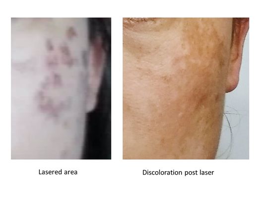 LEE DERMATOLOGY - Updated December 2025 - 63 Reviews - 929 Clay St, San ...