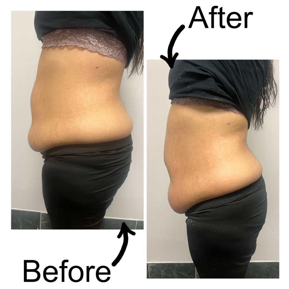 KARMIC KURVES BODY SCULPTING - 20550 Townsen Park Blvd, Humble, Texas - Body Contouring - Phone ...