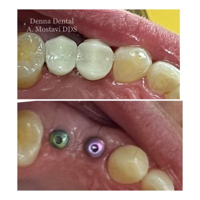 DENNA DENTAL - Updated October 2025 - 18 Photos - 15 Clifton Country Rd ...