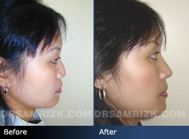 SAM RIZK, MD - Updated October 2025 - 102 Photos & 63 Reviews - 1040 ...