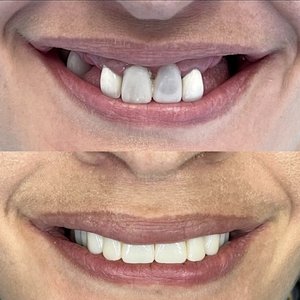 BILL T CAVALLI, DDS - 101 Reviews - 2522 Dana St, Berkeley, CA - Yelp