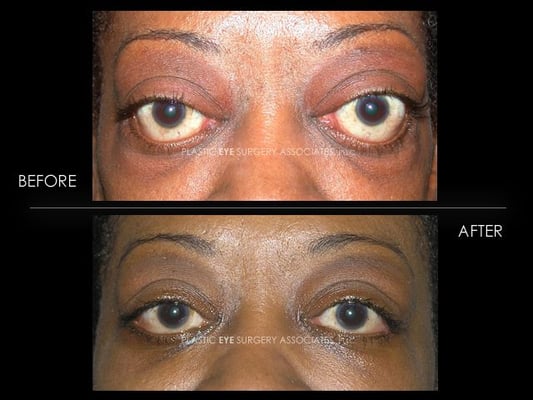 PLASTIC EYE SURGERY ASSOCIATES - Updated May 2025 - 35 Photos & 13 ...