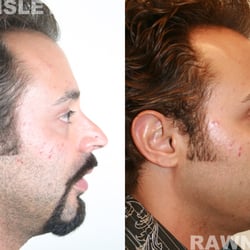 JEFFREY RAWNSLEY, MD - RAWNSLEY PLASTIC SURGERY - 61 Photos & 67 ...