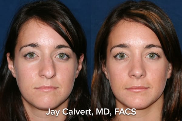 DR JAY CALVERT PLASTIC SURGERY - Updated December 2025 - 39 Photos & 34 ...