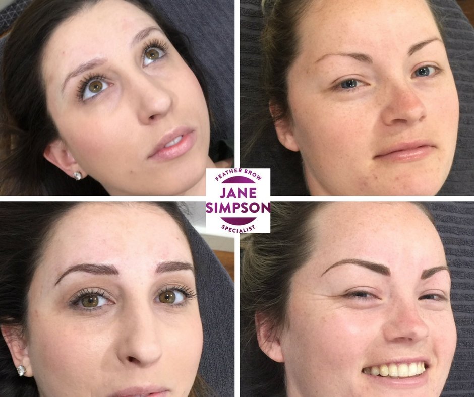 JANE SIMPSON BROWS - Request an Appointment - 963 Pacific Highway ...