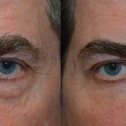 NAFICY PLASTIC SURGERY & REJUVENATION CENTER - 68 Photos & 192 Reviews ...