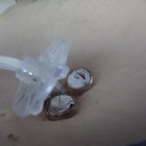 CENTERVILLE POST ACUTE - Updated December 2025 - 27 Photos - 1001 E ...