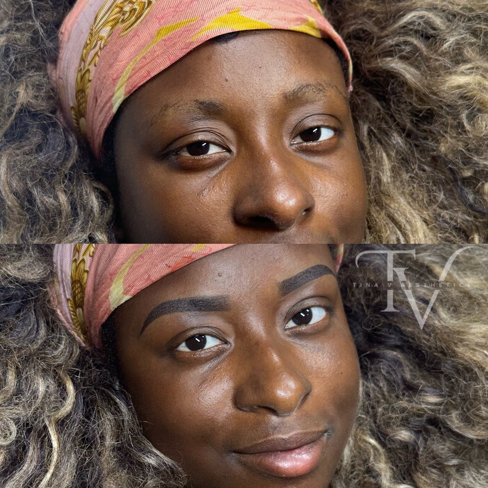 TINA V AESTHETICS - Updated March 2025 - Request an Appointment - 650 ...