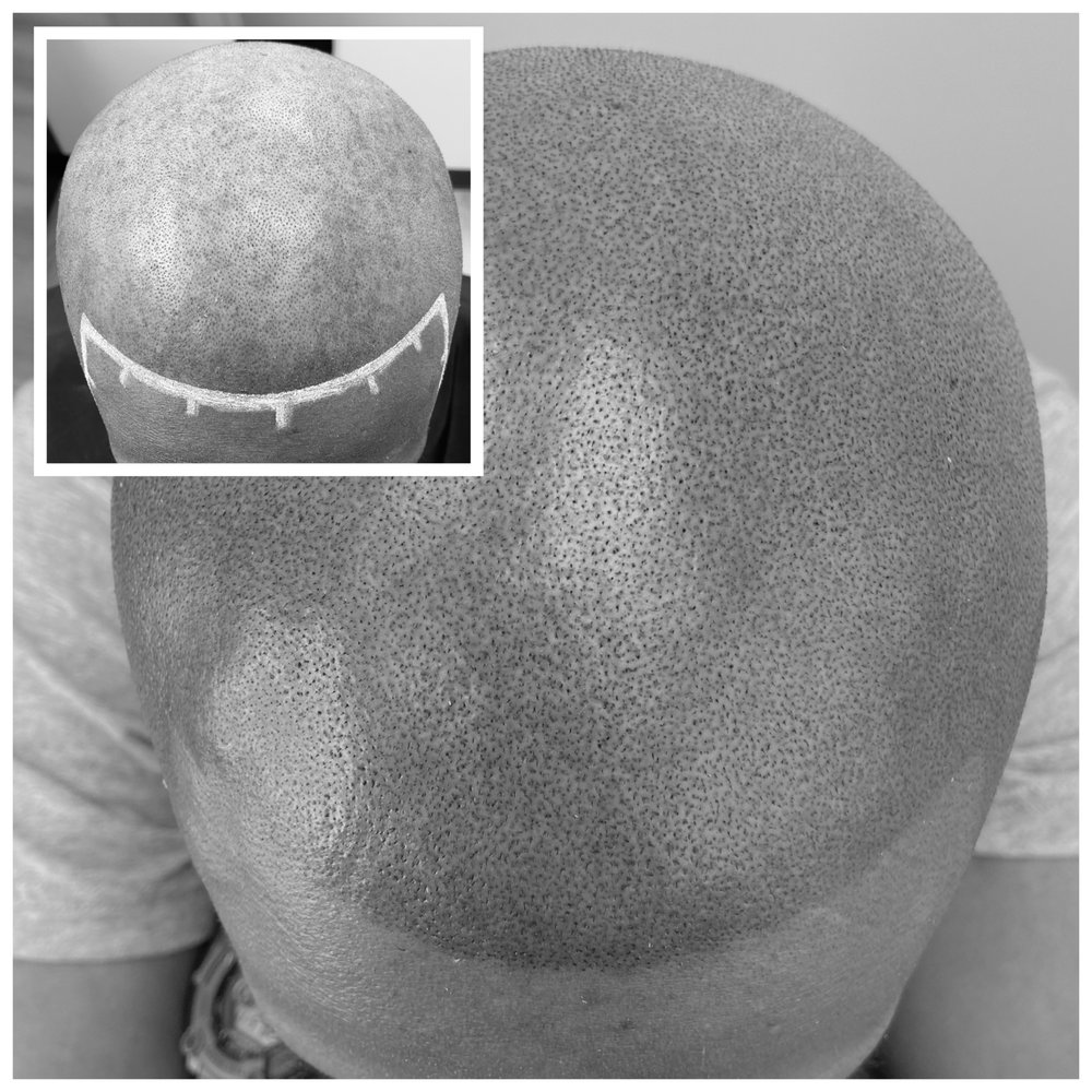 SKALP INK MICROPIGMENTATION - Updated August 2025 - 31 Photos - 9701 ...