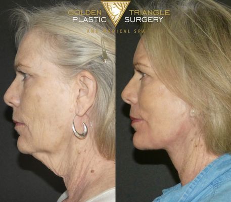 GOLDEN TRIANGLE PLASTIC SURGERY AND MEDICAL SPA - Updated December 2025 ...