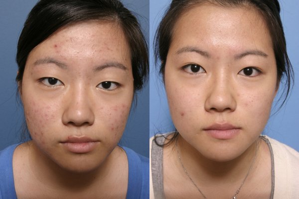 VIP PLASTIC SURGERY - Updated August 2025 - 112 Photos & 72 Reviews ...