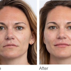 BEAUTYFIX MEDSPA - Updated June 2024 - 102 Photos & 238 Reviews - 18 W 23rd St, New York, New ...