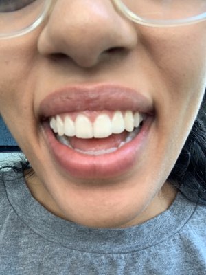 STILES DENTISTRY - Updated May 2026 - 20 Photos & 13 Reviews - 333 Main ...