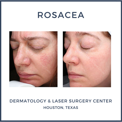 DERMATOLOGY & LASER SURGERY CENTER - Updated May 2025 - 74 Photos & 56 ...