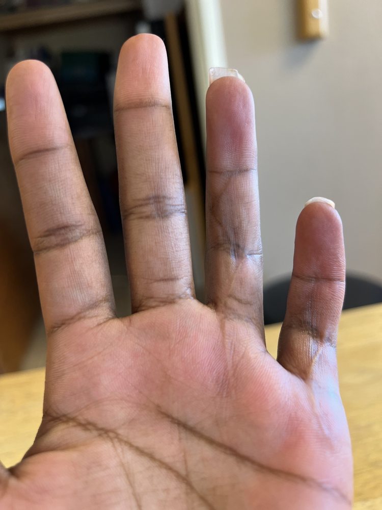 SWIFT INSTITUTE HAND THERAPY - Updated September 2025 - 10 Photos & 22 ...