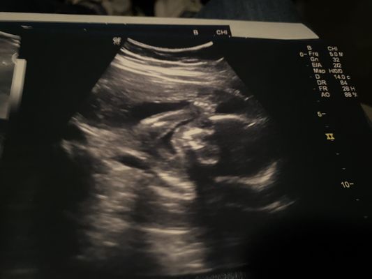 FETAL MEMORIES 2D 3D 4D ULTRASOUND - Updated September 2025 - 151 ...