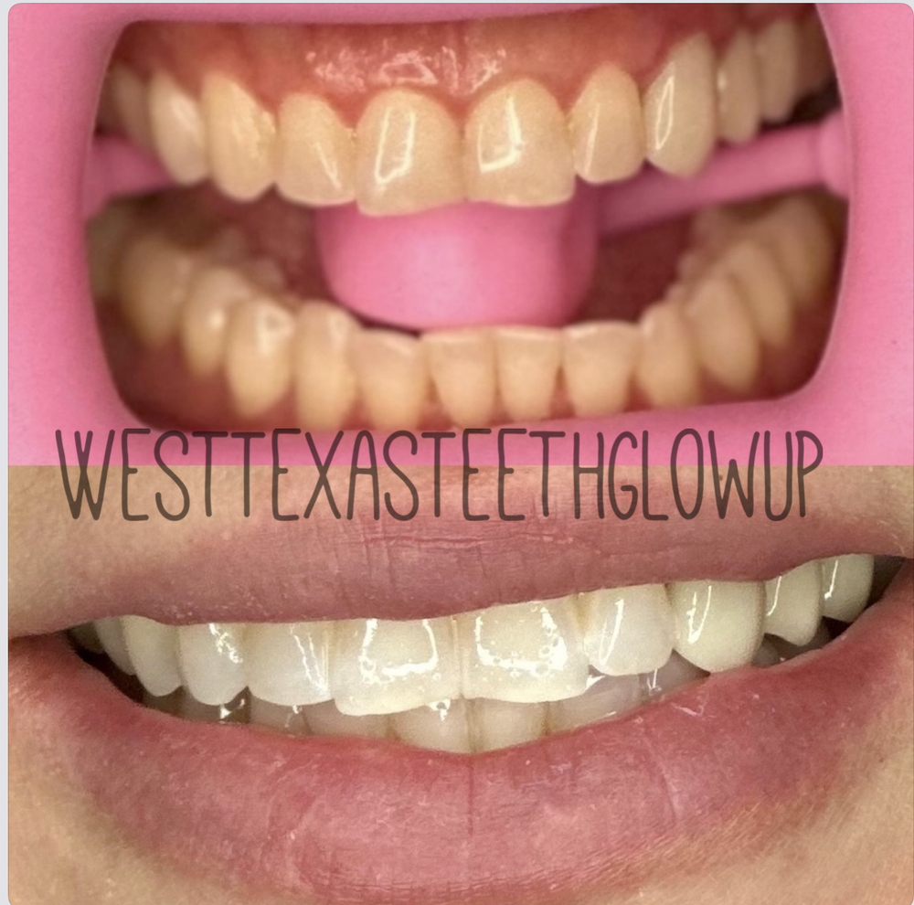 WEST TEXAS TEETH GLOW UP - Updated July 2025 - 11 Photos - 3201 W Wall ...