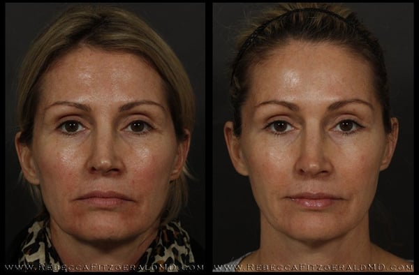 REBECCA FITZGERALD, MD - Updated December 2025 - 34 Photos & 188 ...