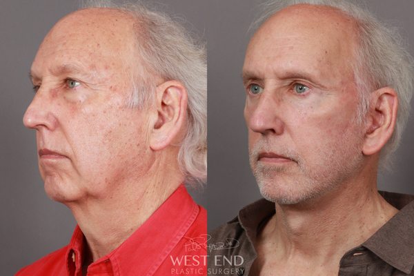 PAUL G RUFF IV, MD FACS - Updated September 2025 - 25 Photos - 2440 M ...