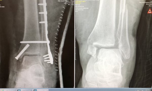 UBMD ORTHOPAEDICS & SPORTS MEDICINE - Updated June 2026 - 30 Photos ...