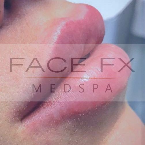FACEFX MED SPA - Updated May 2024 - 10367 78 Avenue NW, Edmonton ...