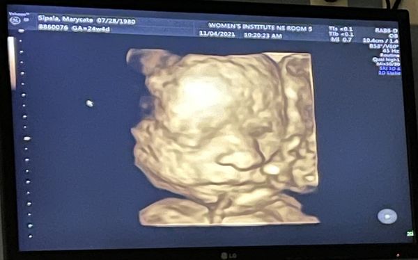 ATRIUM HEALTH - CABARRUS - Updated July 2025 - 57 Photos & 71 Reviews ...