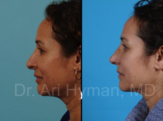 ARI HYMAN, MD - Updated October 2024 - 388 Photos & 57 Reviews - 16311 ...