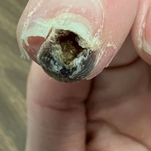 FOREFRONT DERMATOLOGY COLUMBUS, OH - Updated December 2025 - 12 Reviews ...