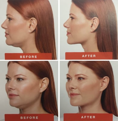 JIMMY S. FIROUZ, MD, FACS - 167 Photos & 367 Reviews - 416 N Bedford Dr ...