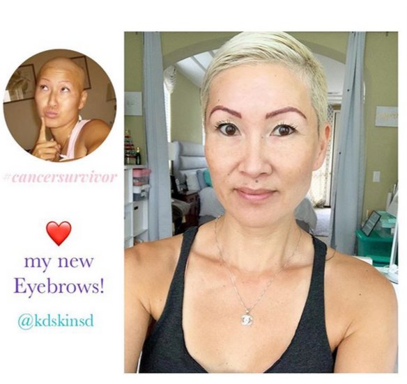 KD SKIN - Updated July 2025 - 66 Photos & 66 Reviews - La Mesa ...