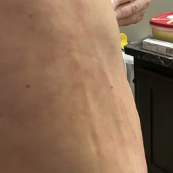 PURE PLASTIC SURGERY - 25 Photos & 24 Reviews - 7265 SW 93rd Ave, Miami ...