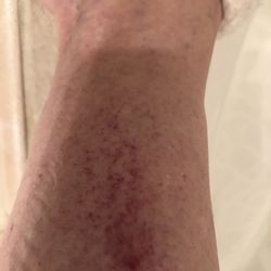 SCOTT C RACKETT, MD - MANHATTAN BEACH DERMATOLOGY - 31 Photos & 46 ...