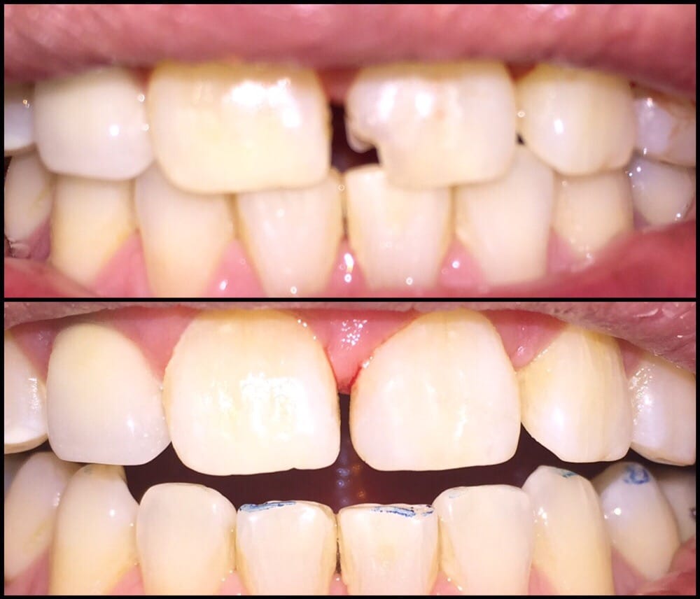 DAVID KRONER, DDS - KADI DENTAL - Updated October 2025 - 88 Photos & 28 ...