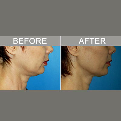 SHARON GIESE, MD - Updated October 2025 - 31 Photos & 13 Reviews - 114 ...