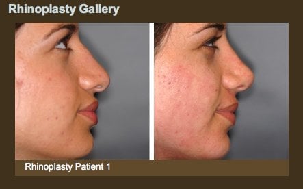 BARRY S. HANDLER, MD, FACS - Updated May 2026 - 11 Photos & 44 Reviews ...