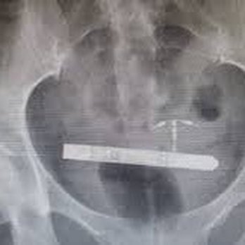 WALMART SUPERCENTER - Updated January 2026 - 13 Photos & 18 Reviews ...