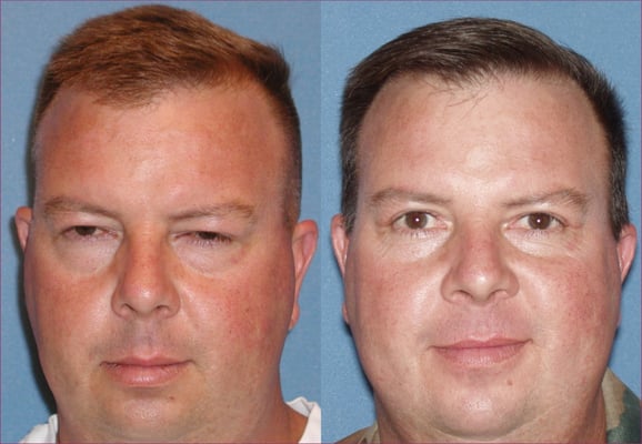 ARIZONA EYE INSTITUTE & COSMETIC LASER CENTER - Updated September 2024 ...