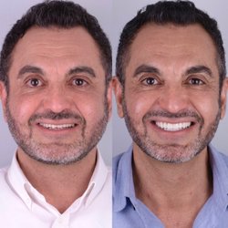 NADER YERMIAN, DDS - VICENTE DENTAL - 116 Photos & 158 Reviews - 11633 ...