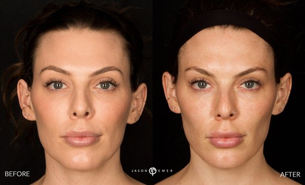 JASON EMER, MD - Updated July 2024 - 1041 Photos & 464 Reviews - 9201 ...