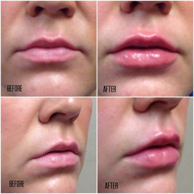 JOHN J. COREY, MD - AESTHETIC PLASTIC SURGERY - Updated December 2025 ...