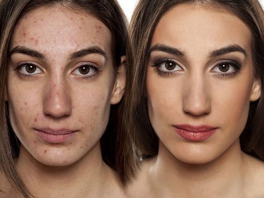 CLEAVER MEDICAL GROUP INTERVENTIONAL PAIN - 59 Tipton Dr, Dahlonega ...